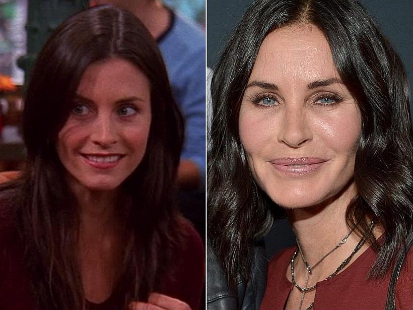 Monica de Friends se arrepintió de las cirugías que cambiaron su rostro